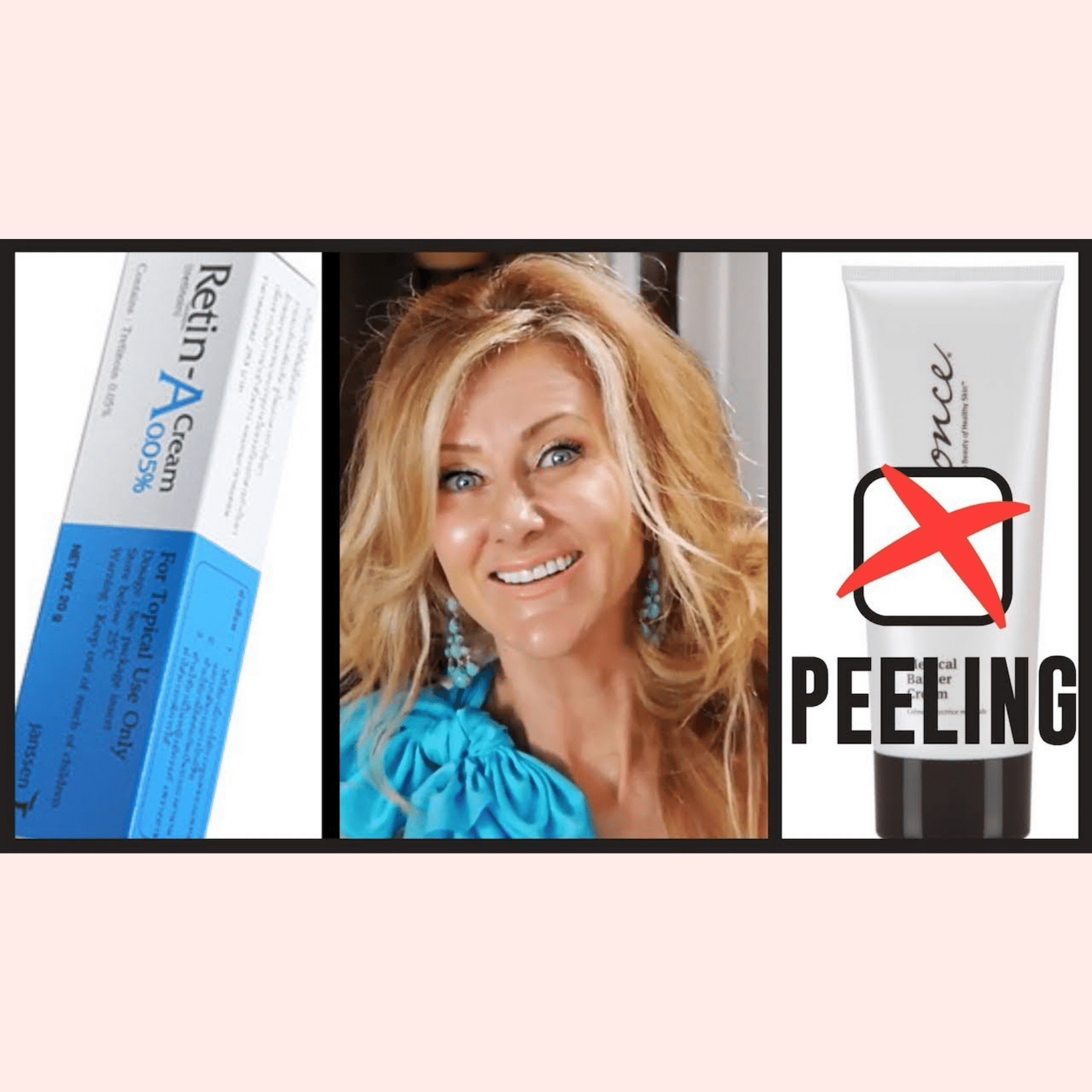 Skin Care Treatment For wrinkles | How To Look Younger Using Retin-A!