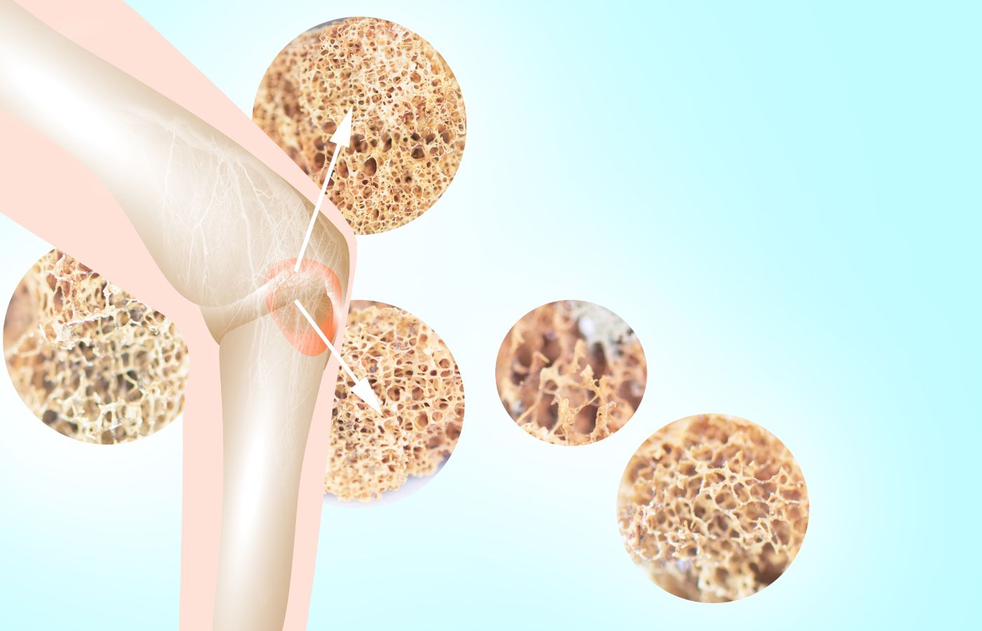 8 Effective Ways to Prevent Bone Loss During and After Menopause