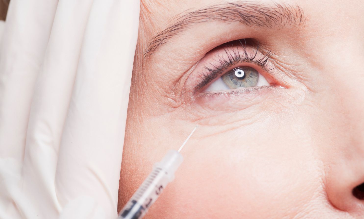 Botox vs Daxxify: Which One Is Best For You? - Fabulous50s